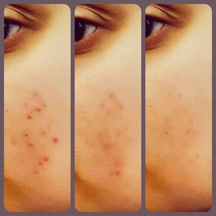 Upgrading clients to advanced facials - WOW facial